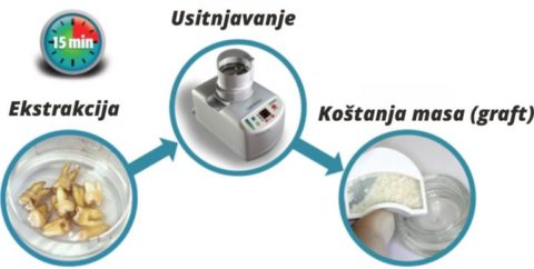 Smart dentin grinder